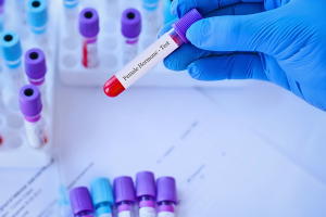 Understanding Optimal Progesterone Levels in IVF for Treatment Success ...